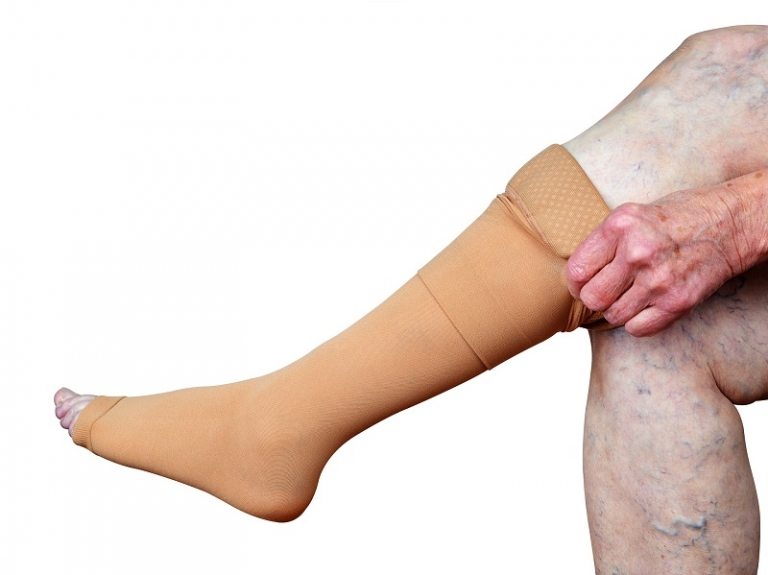 Herken een Trombosebeen - Trombosestichting